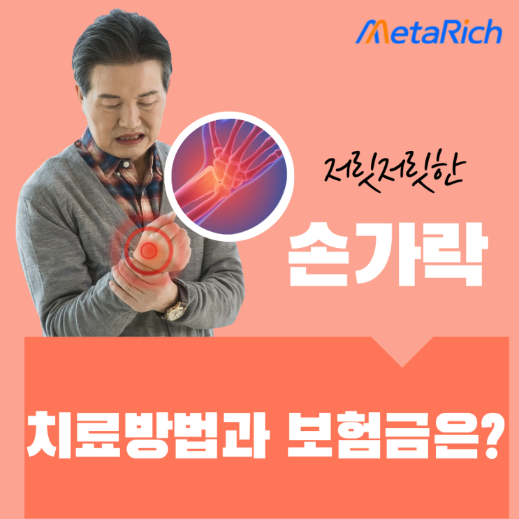 방아쇠 수지 유리술(손가락 수술), 보험 보장될까? : 네이버 블로그