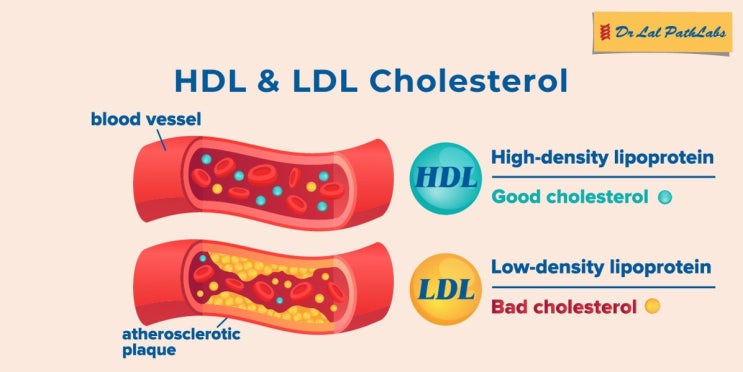 [159] HDL/LDL 콜레스테롤 : 네이버 블로그
