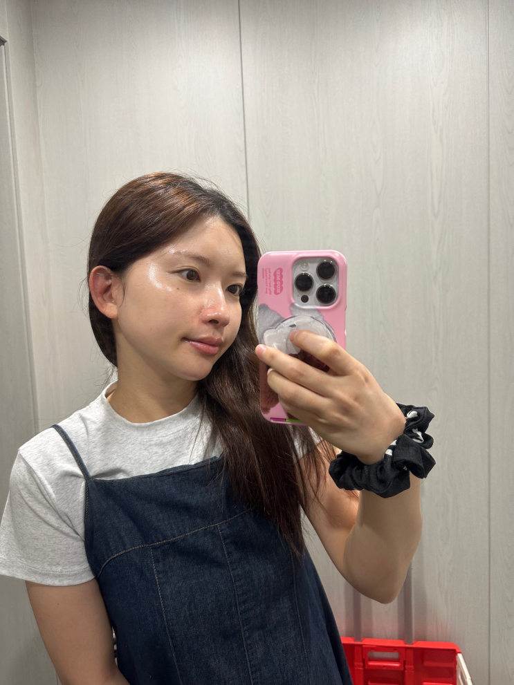 부산 써마지FLX 300샷 시술 후기 (+무통수액) : 네이버 블로그