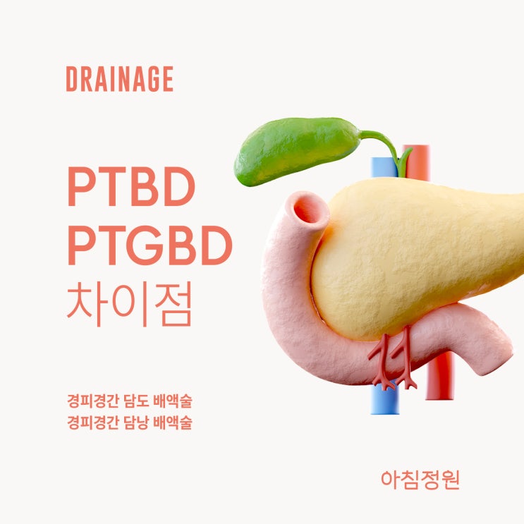 의학용어 PTBD PTGBD 시술 하는 이유와 간호 시 주의사항 | 배액관 시술 하는 병원 : 네이버 블로그