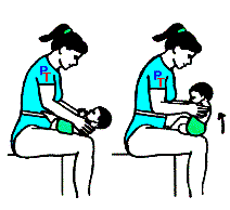 🧒🏻 소아 상체 들어올리기 훈련 (Pull-to-Sit) : 네이버 블로그