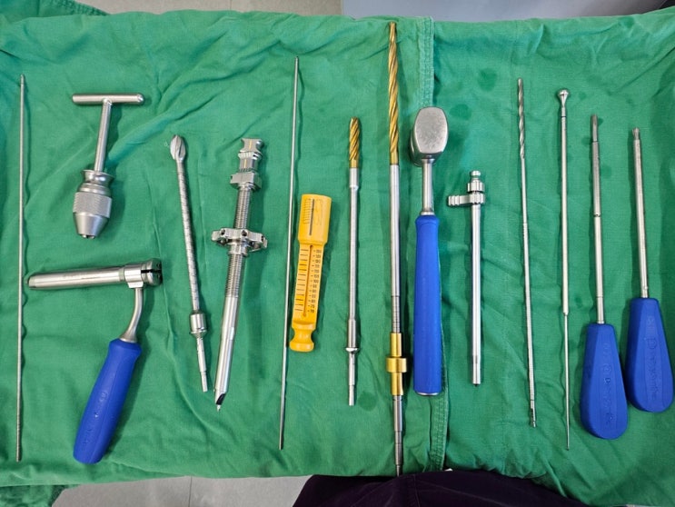 이미지로 설명하는 TFNA 수술과정 완벽 정리! TFNA 기구(DePuy Synthes), TFNA procedure, TFNA ...