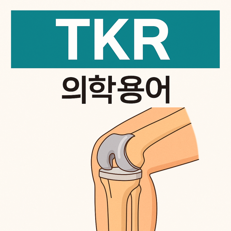 의학용어 TKR, 무슨 뜻인지 알아보기 : 네이버 블로그