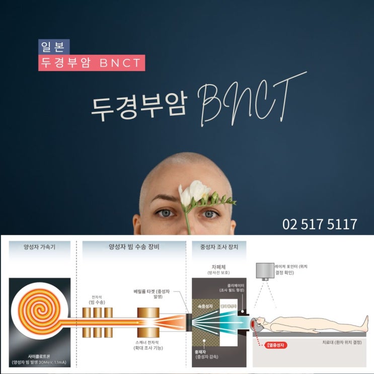 두경부암 붕소중성자 포획치료(BNCT) : 네이버 블로그