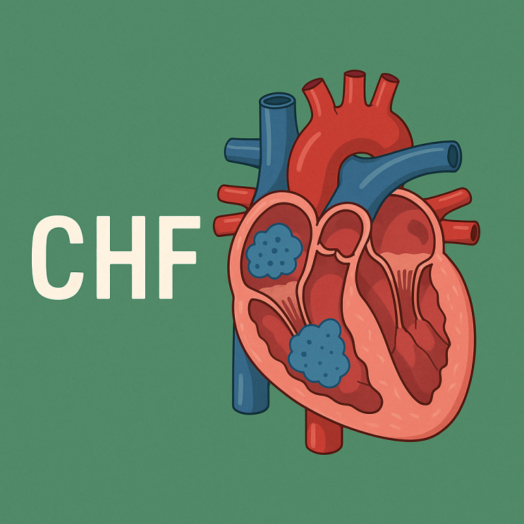 의학용어 CHF (Congestive Heart Failure, 울혈성 심부전) 완벽 정리 : 네이버 블로그