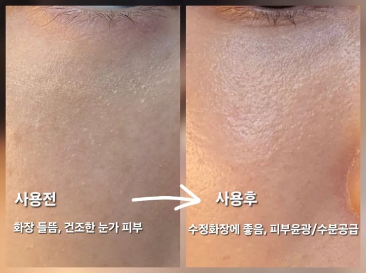 [코스알엑스] 더 세라마이드 스킨 베리어 모이스처라이징 미스트 120ml 사용후기 : 네이버 블로그