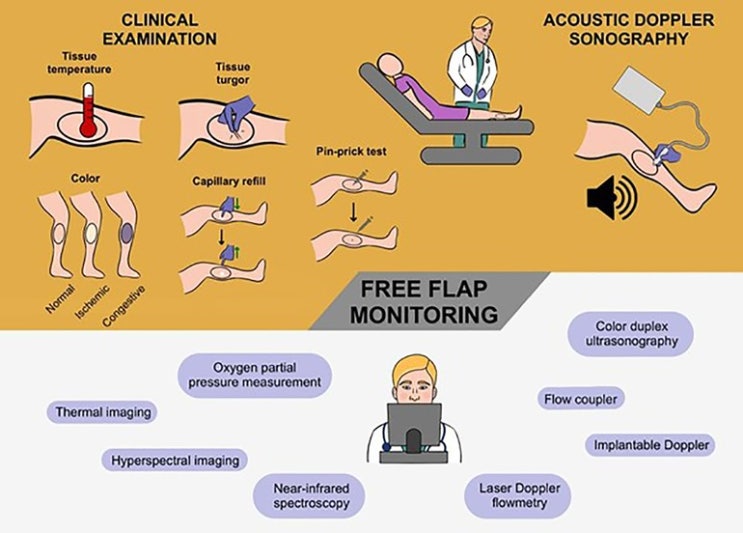 Free Flap (유리피판술) Post-op Flap Monitoring Protocol, 수술 후 피판 모니터링 체크리스트 ...