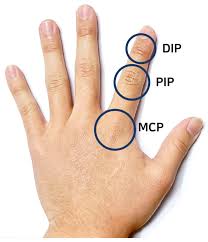 손가락의 관절: PIP, MCP, DIP : 네이버 블로그