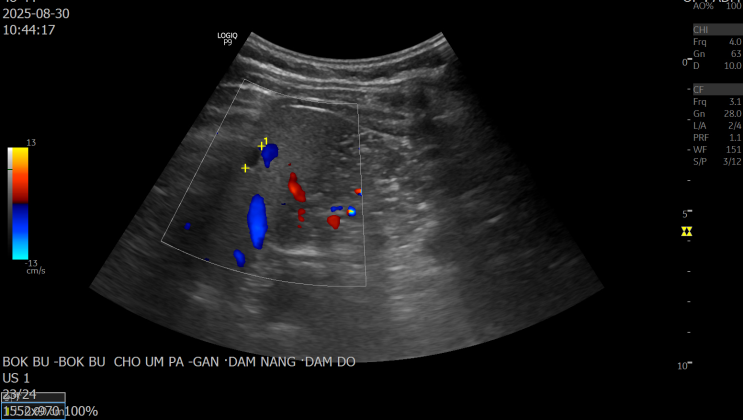 beaver's tail liver : 네이버 블로그