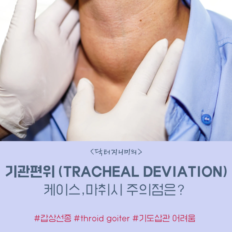 기관 편위 (tracheal deviation) 케이스, 마취 시 무엇을 조심해야 할까? 이유와 증상 : 네이버 블로그