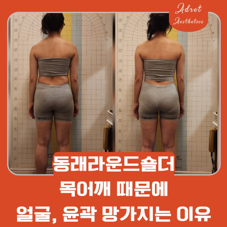 동래라운드숄더 목어깨 때문에 얼굴과 윤곽까지 망가지는 이유 : 네이버 블로그