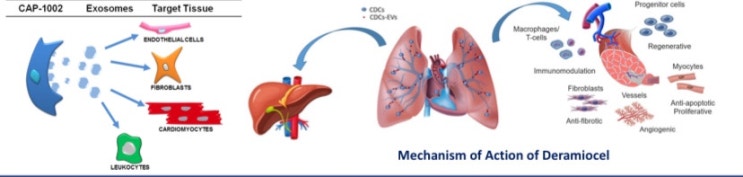 Capricor Therapeutics, 듀센근이영양증(DMD) 심근병증 치료제 Deramiocel FDA 허가 신청 완료 ...