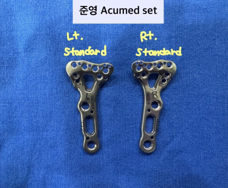OR/IF Distal radius(anatomy,procedure,plate종류) : 네이버 블로그