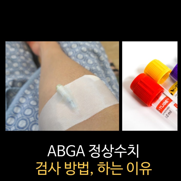 ABGA 정상수치 얼마, 검사방법, 동맥혈가스분석 하는 이유 : 네이버 블로그