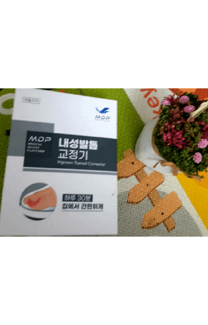 MDP 내성발톱 교정기, 내성발톱 집에서 해결하는 방법 : 네이버 블로그