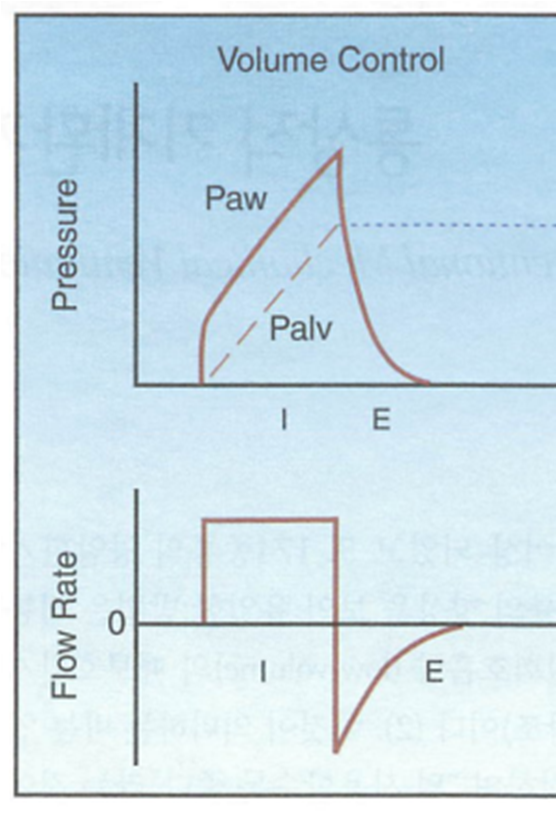 Ventilator Setting 1편 - Mode (VCV, PCV / ACMV, SIMV, PS/PSV) : 네이버 블로그