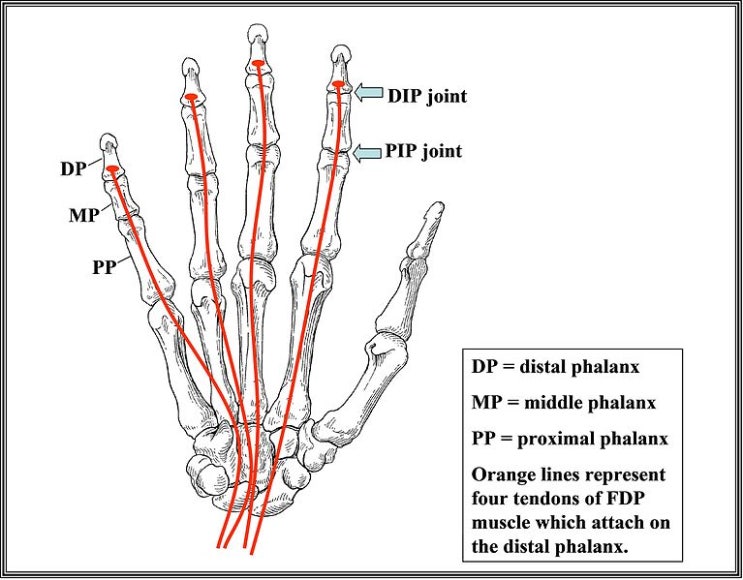 Finger amputation 환자 수술 준비 - thenar flap 과 Detach 과정 총정리 : 네이버 블로그
