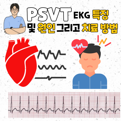 PSVT 발작성 상심실성 빈맥 원인 및 EKG 특징과 증상 그리고 치료방법 : 네이버 블로그