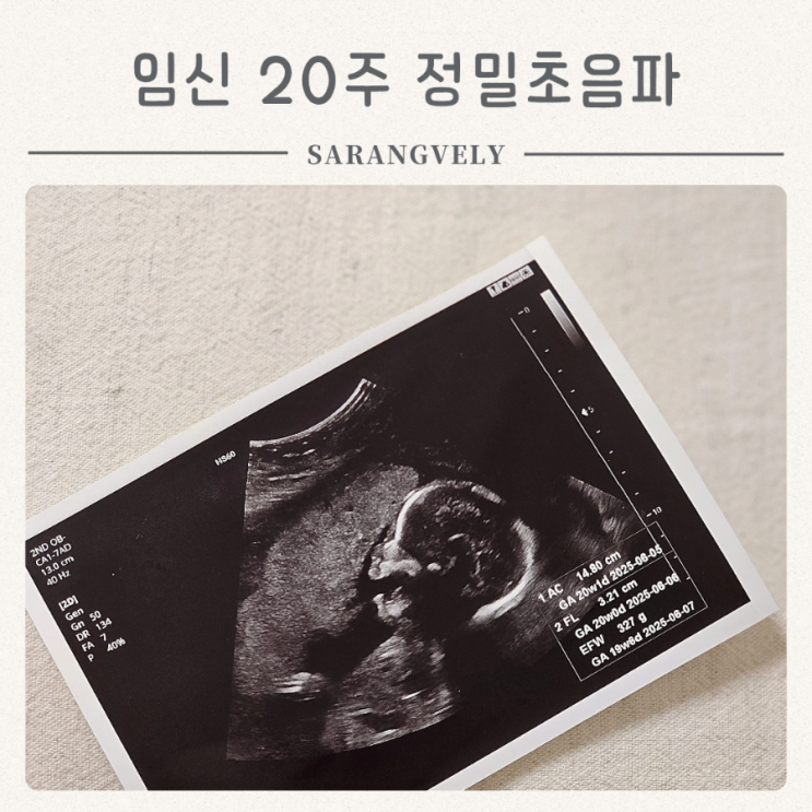 임신 20주 정밀 초음파 검사 시기 첫 입체 초음파 네이버 블로그