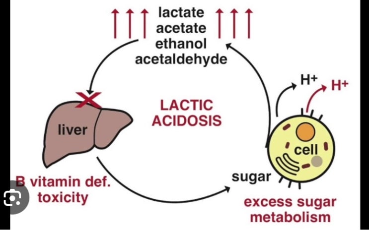 대사성 산증 (Metabolic acidosis), Lactate, Lactic acidosis 젖산산증 수치, Anion ...