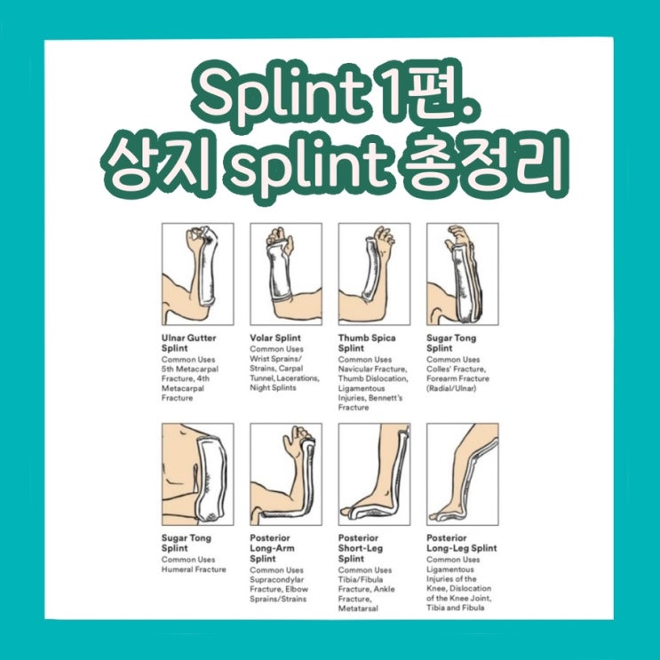 [응급실간호] splint 종류 1편. 상지 splint, armsling 총정리 : 네이버 블로그