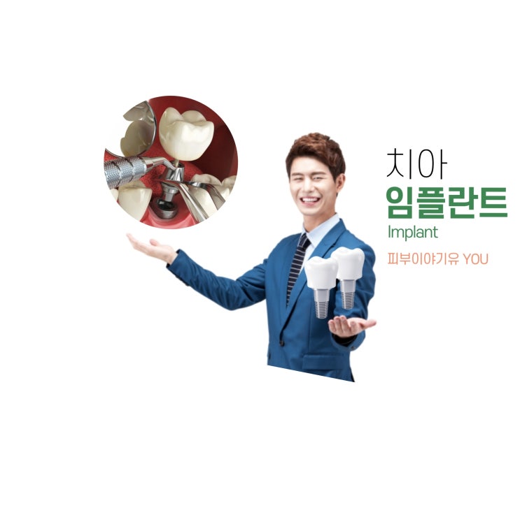 치아 임플란트 시술받은 후 코 부위에서 썩은 냄새가 나는 이유, 대처 방법 : 네이버 블로그