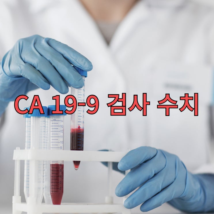 CA 19-9 검사 수치 의미 : 네이버 블로그