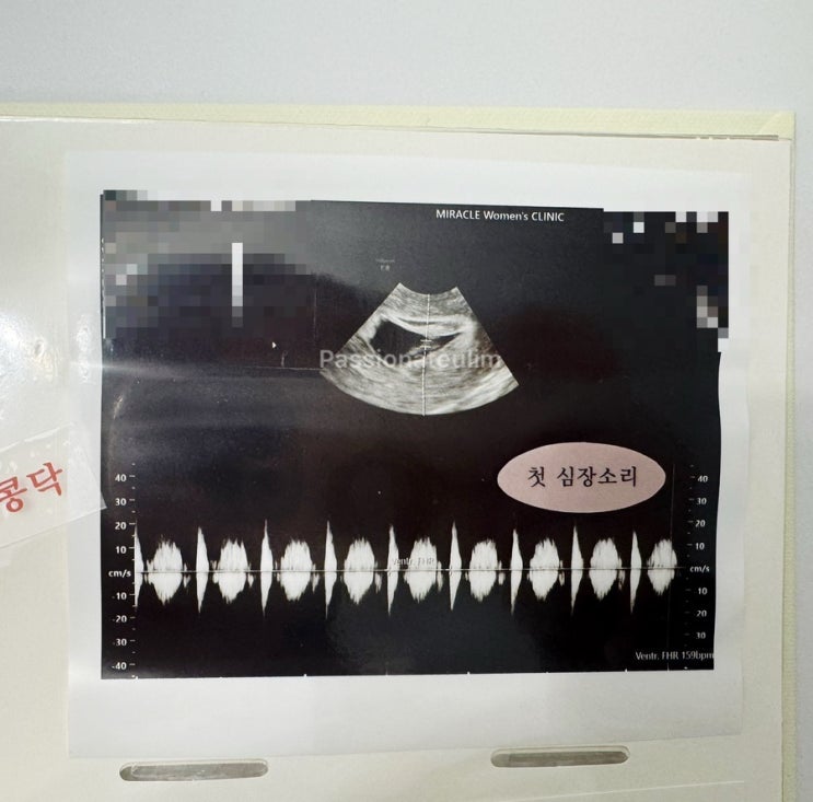 [6w0d~7w2d]입덧의 시작과 경이로운 심장소리 듣기(산모수첩,입덧약처방,콩주사맞기,산전검사) : 네이버 블로그
