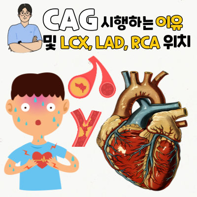 CAG(Coronary Angiography) 시행하는 이유와 RCA, LCA, LCX, LAD 위치는? : 네이버 블로그
