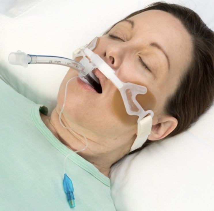 67) E-tube(ET-tube): Endotracheal tube, T-tube: T-tube 사이즈 및 용도 정리 ...