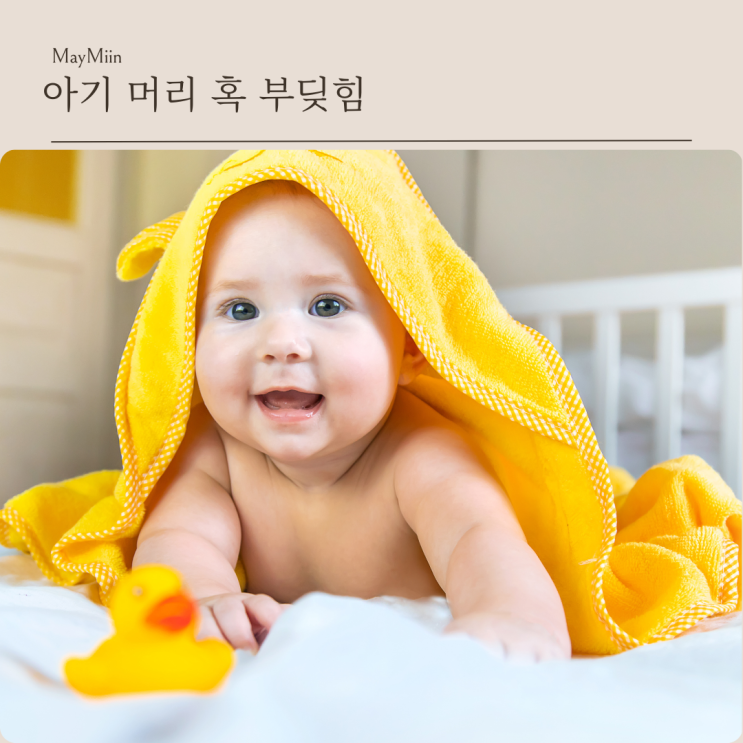 아기 머리 보호대 부딪힘 병원 혹 네이버 블로그