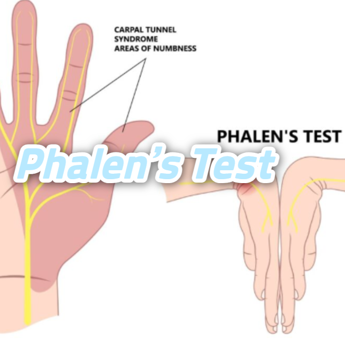 Phalen's test 손목 통증과 저림 증상, 손목터널 증후군 테스트 하기 : 네이버 블로그