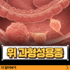 위 과형성용종 위내시경 증상 치료 네이버 블로그
