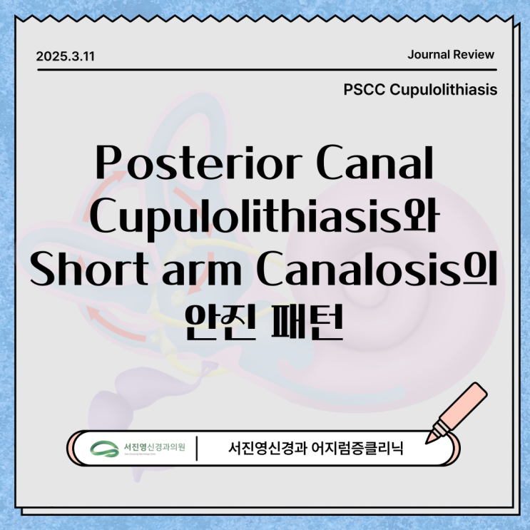 [BPPV][학술] Posterior canal short arm canalolithiasis의 개념과 PSCC ...