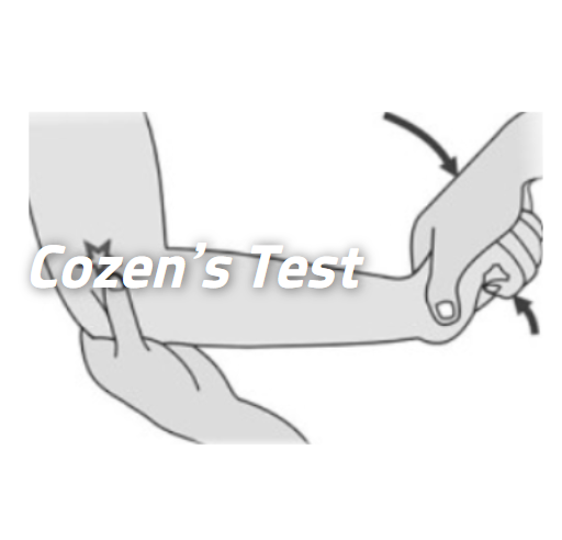 Cozen's Test 코젠테스트 로 확인하는 테니스 엘보(외측 상과염) 진단 방법과 치료법 : 네이버 블로그