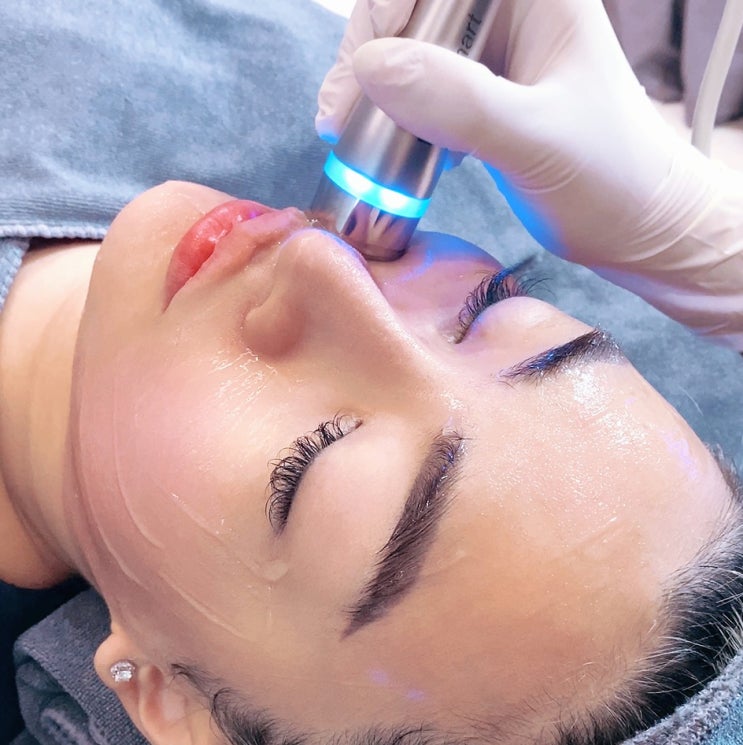 피부과 LDM 물방울 리프팅 관리 효과 부작용 주기 (의사 작성) : 네이버 블로그