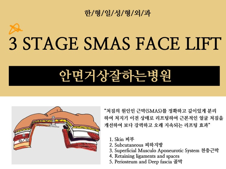 안면거상술 스마스(SMAS)와 유지인대(retaining ligaments) : 네이버 블로그