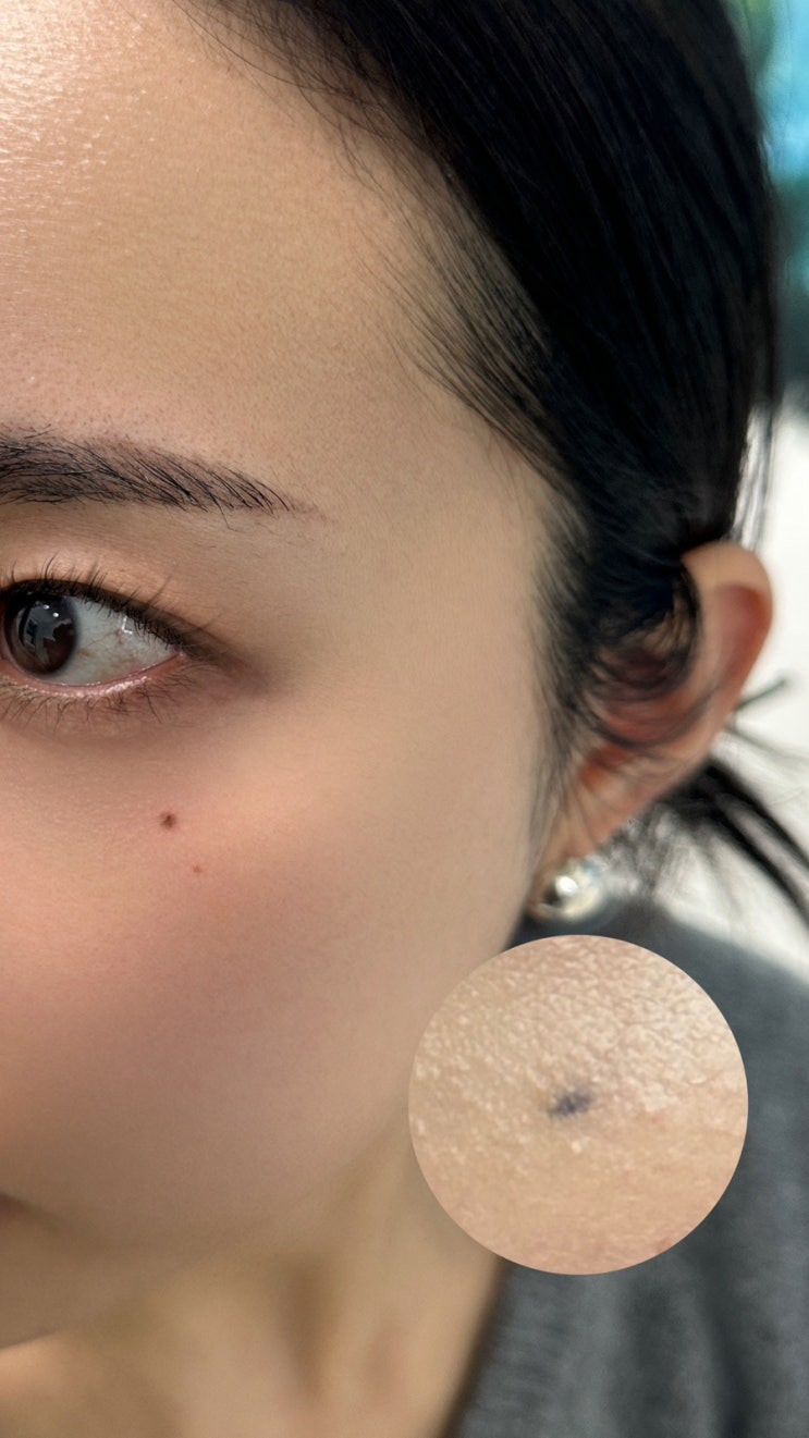 대구반영구 대구뷰티점 대구뷰티점잘하는곳 모어댄 솔직후기 : 네이버 블로그