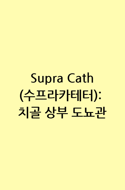Supra Cath(수프라카테터): 치골 상부 도뇨관의 모든 것 : 네이버 블로그