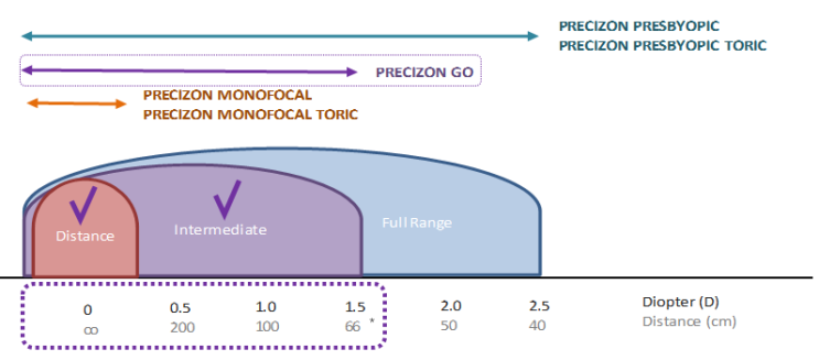 프리시즌 고(Precizon GO) 렌즈의 초고도근시 교정 효과 : 네이버 블로그