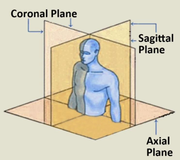 의료 영상에서의 Coronal, Sagittal, Axial Plane 이해하기 : 네이버 블로그