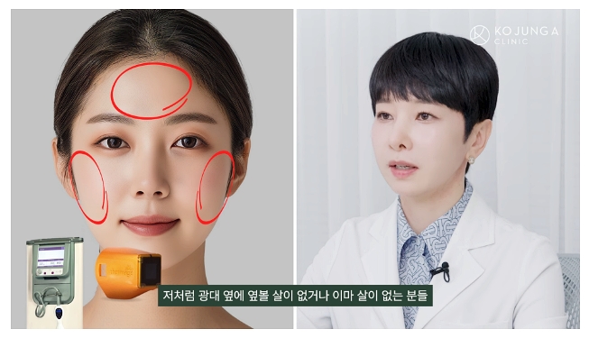 풀써마지 써마지FLX 600 고정아클리닉에서 맞춤으로 : 네이버 블로그
