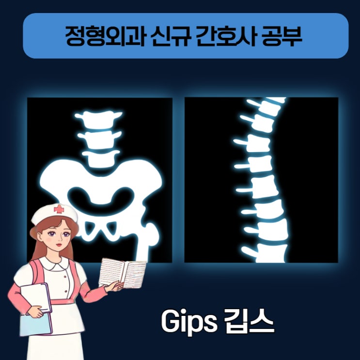 [정형외과 신규간호사 공부]Gips 종류 - cast / splint 적응증 및 방법 : 네이버 블로그