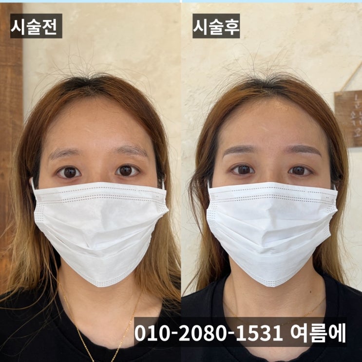 창원 상남동 눈썹 가격 비용, 잘 하는 곳(시술 전, 후 사진) : 네이버 블로그