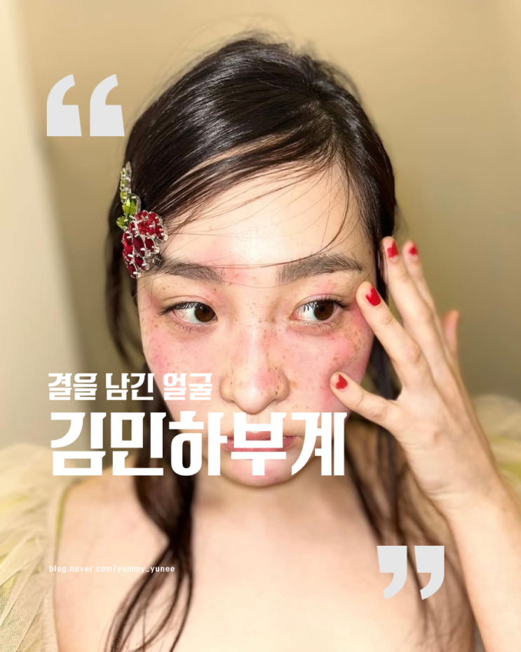 결이 남는 얼굴, 태풍상사 오미선 _ 김민하주근깨가 만든 리얼 스킨의 미학 : 네이버 블로그