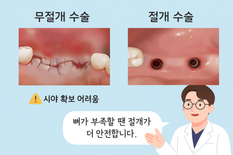 신흥동 치과, 고령자나 전신질환 환자에게 유리한 최적의 경로를 찾는 모의수술, 네비게이션 임플란트 : 네이버 블로그