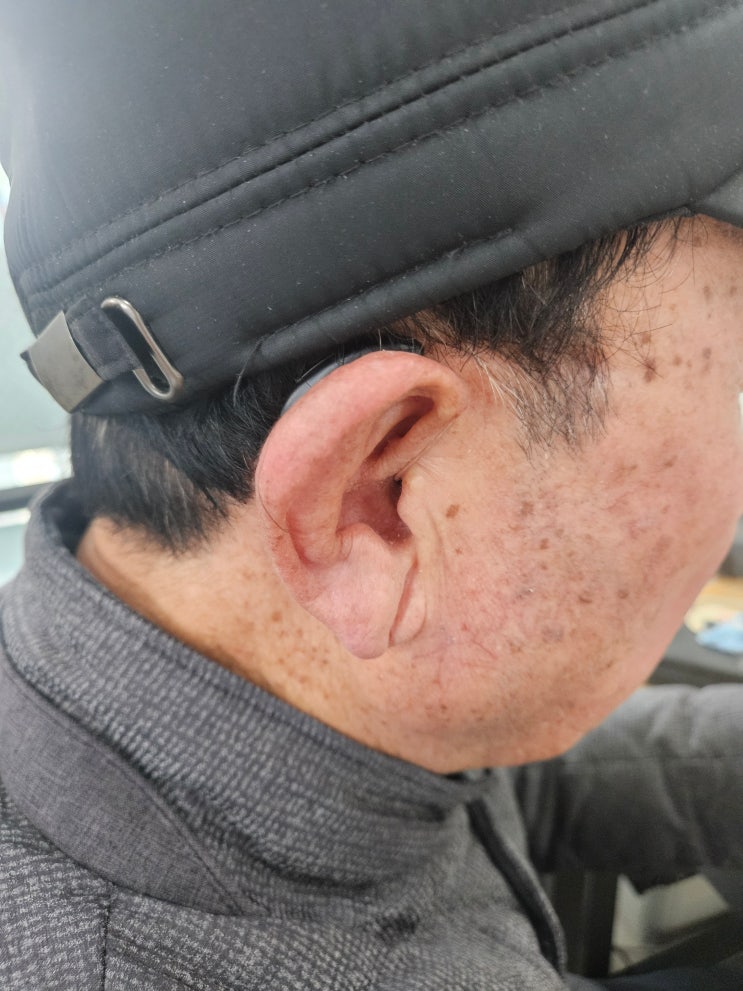 정읍보청기, 👂 시그니아 퓨어 C&G Pure AX 남성 착용 후기 : 네이버 블로그