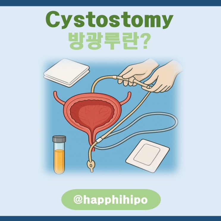 의학용어 Cystostomy(방광루)란? 시술, 소독, 교체, 교체주기, 교체방법, 간호, 관리, catheter ...