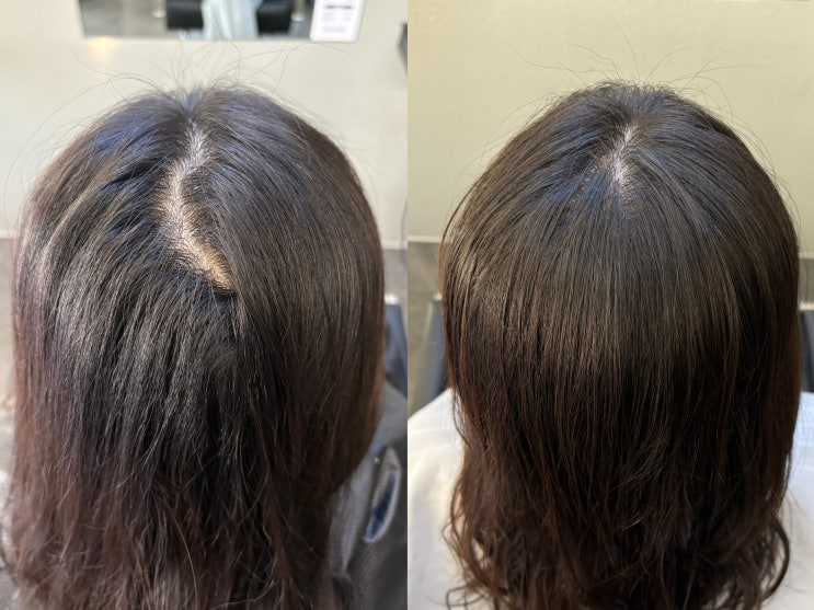 울산삼산미용실 그루드헤어만의 비어보이는 뒷가마 모류교정펌 시술 후기 : 네이버 블로그