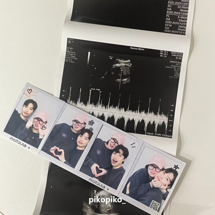 [🤰🏻임신일기 35-36주차 기록] 무한 약속 잡기, 태동검사, 균검사, 몸무게, 튼살근황, 만삭사진, 횡아 이슈와 갑분 제왕 ...